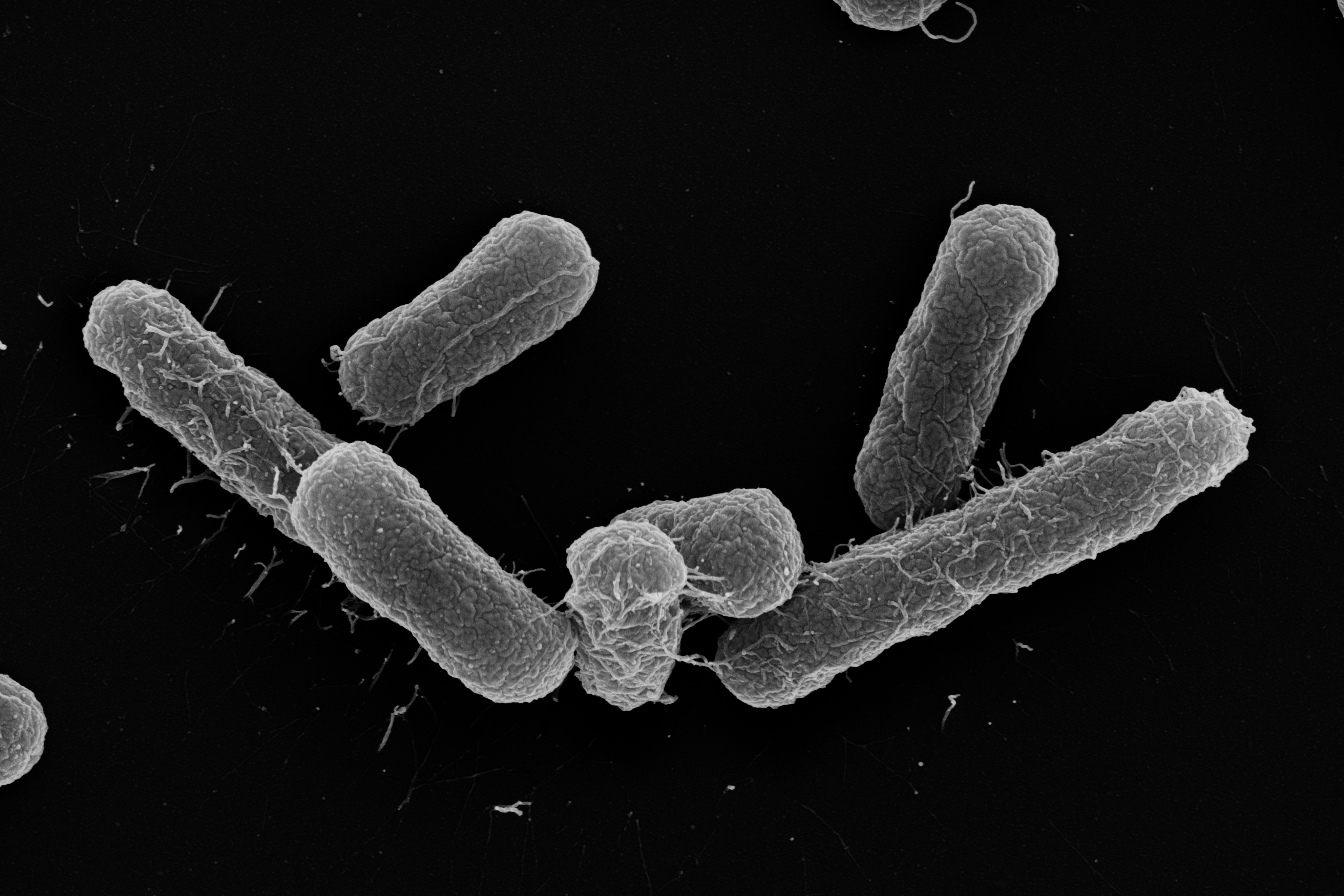 Multiresistant intestinal bacteria: Displacement through food ...