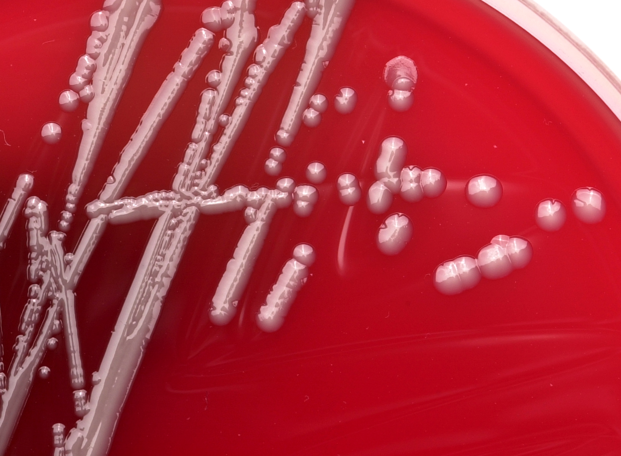 Weitere Verbreitung von Carbapenem-resistentem Acinetobacter baumannii ...