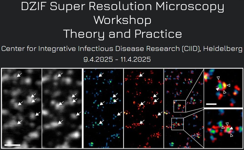 DZIF Super Resolution Microscopy Workshop—Theory and Practice | German ...