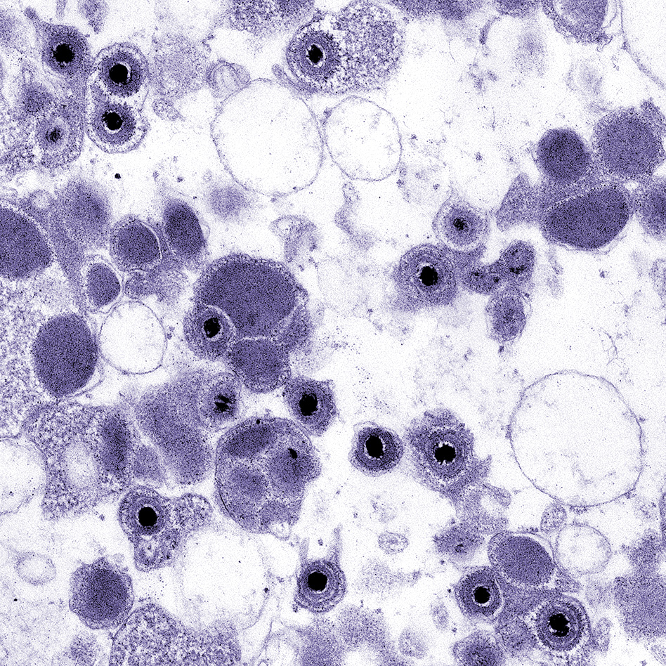 A virus lurking in the connective tissue | German Center for Infection ...