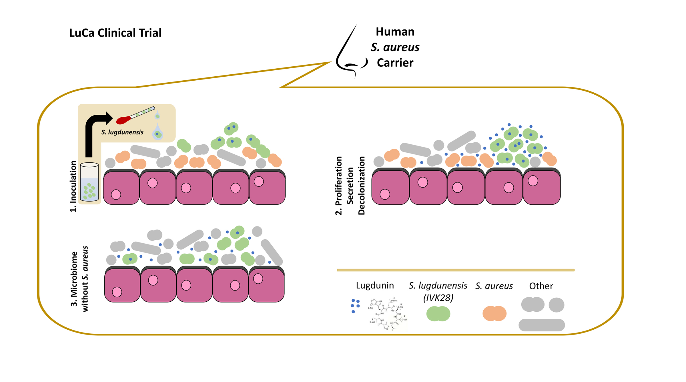 Clinical development of two antimicrobial agents funded by Else Kröner ...