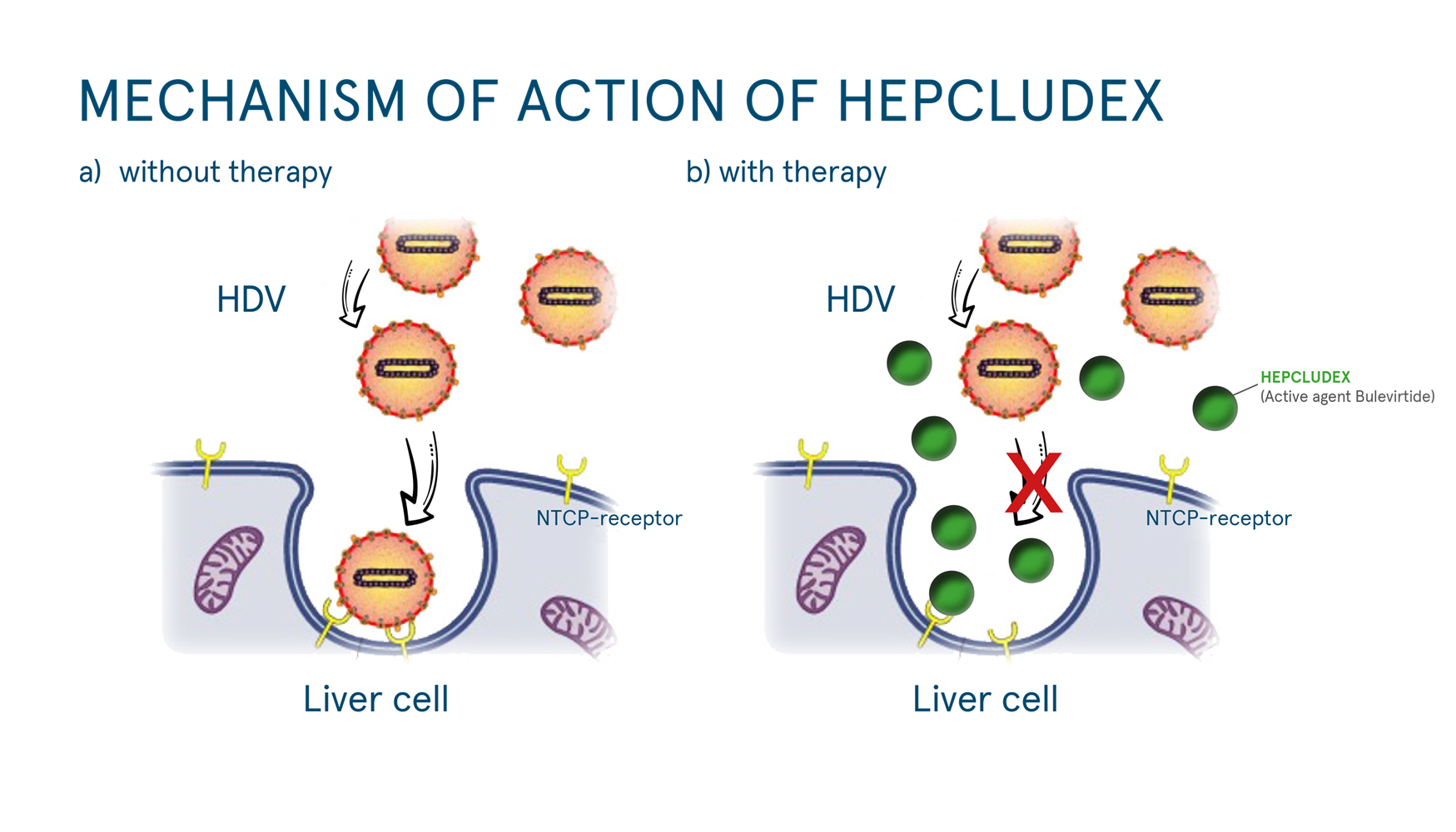 Hepcludex: First drug for hepatitis D has been approved | German Center ...