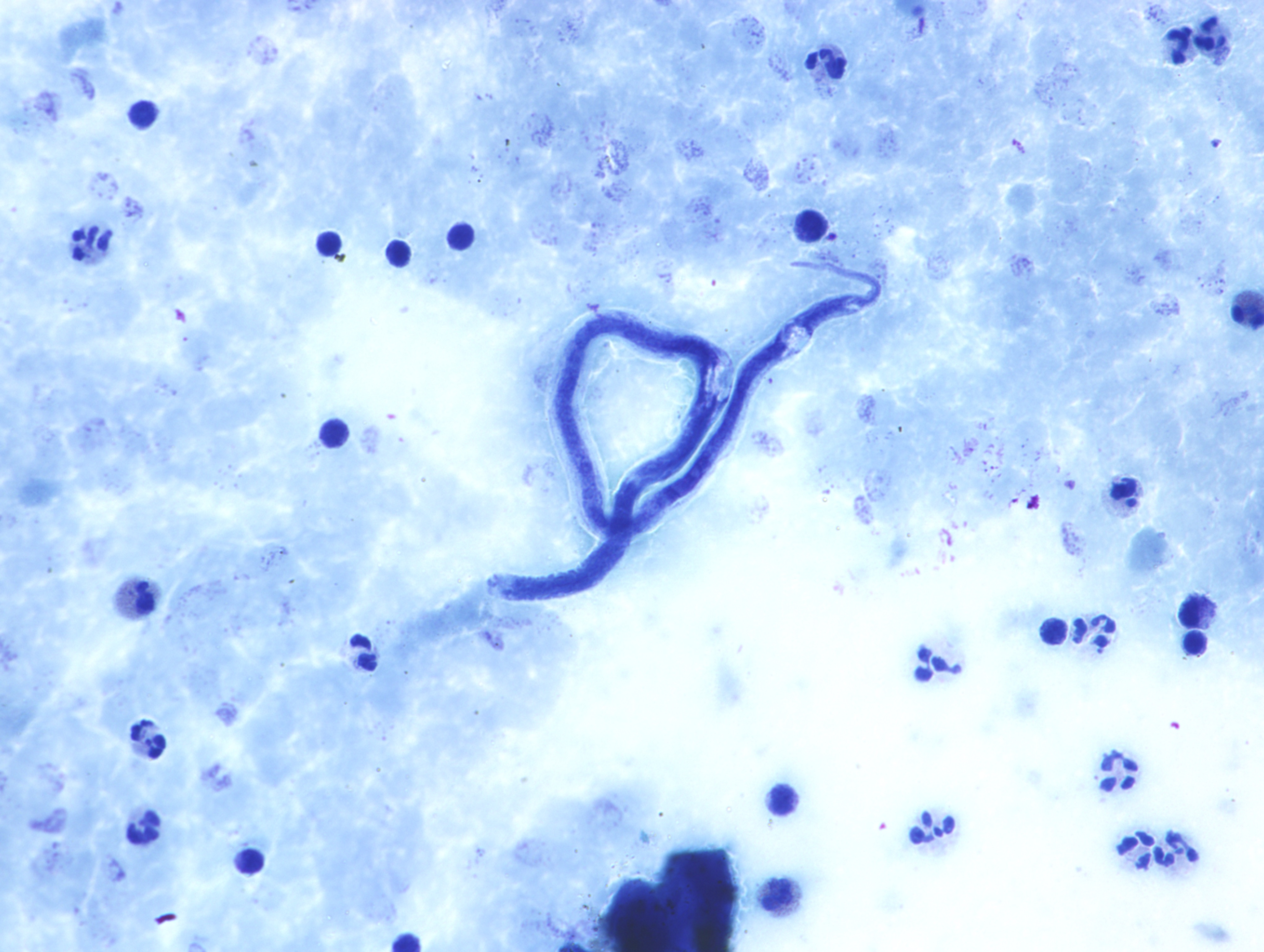 Neglected Tropical Diseases | German Center for Infection Research