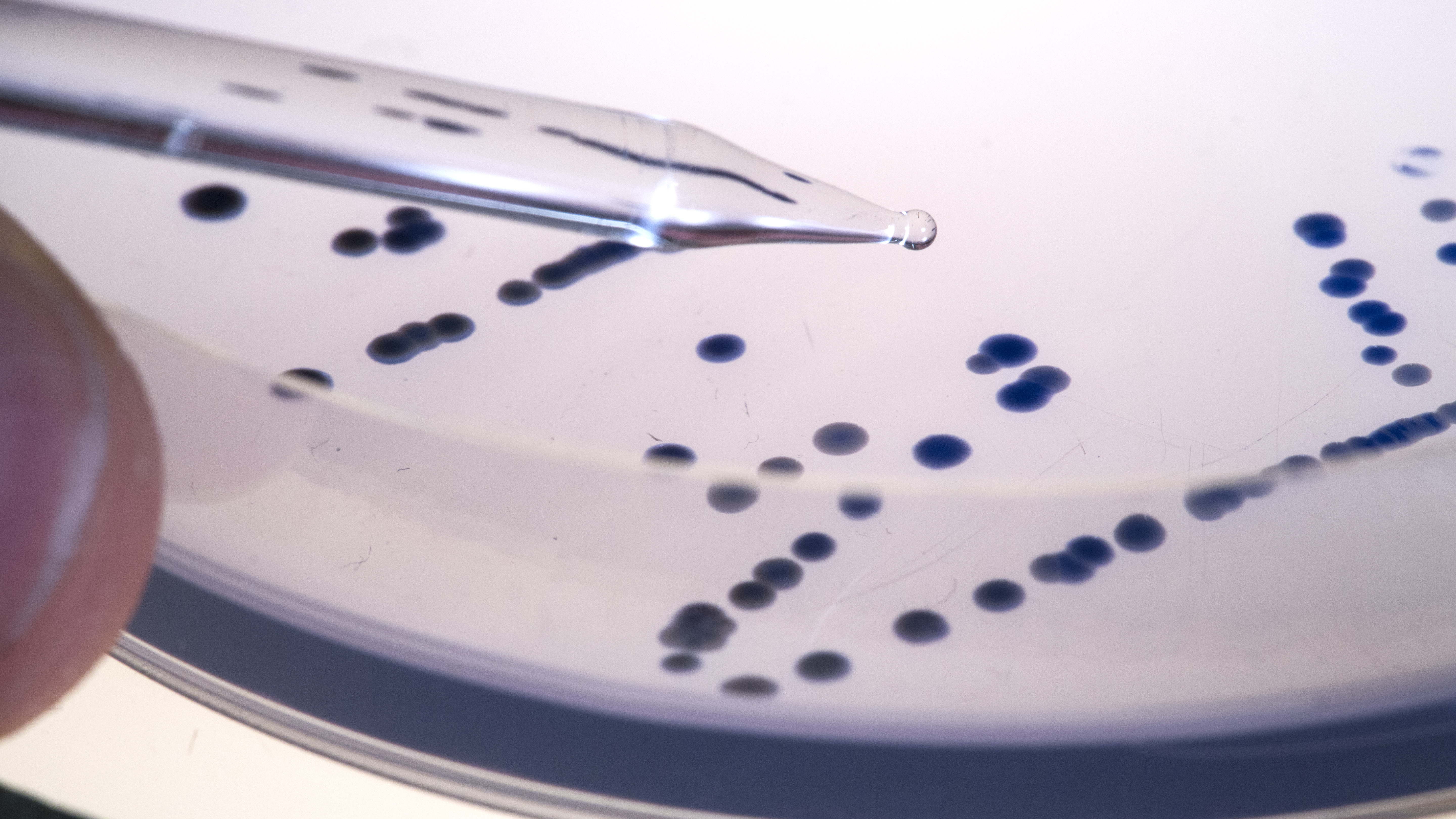 BioVersys AG and Helmholtz Centre for Infection Research join forces to ...