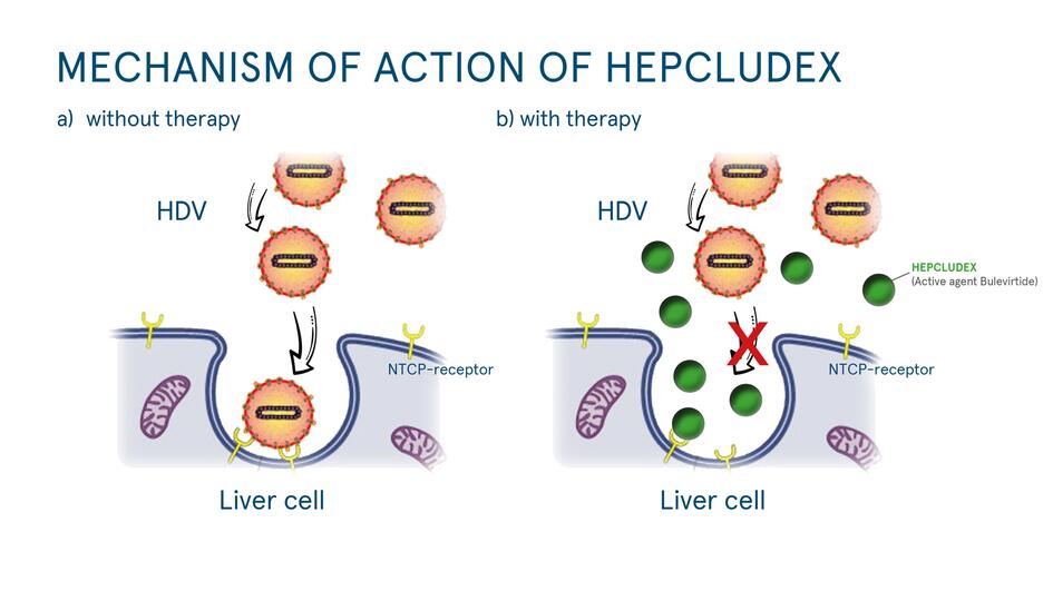 Hepcludex: First drug for hepatitis D has been approved | German Center ...